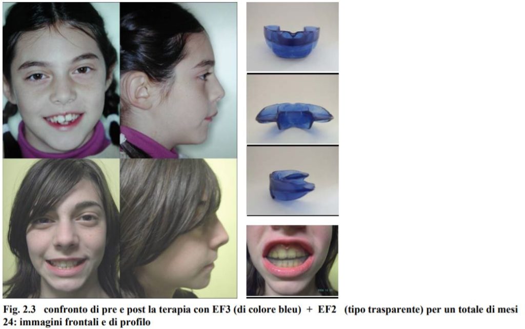 CC2. fig 3 - Dentalsim