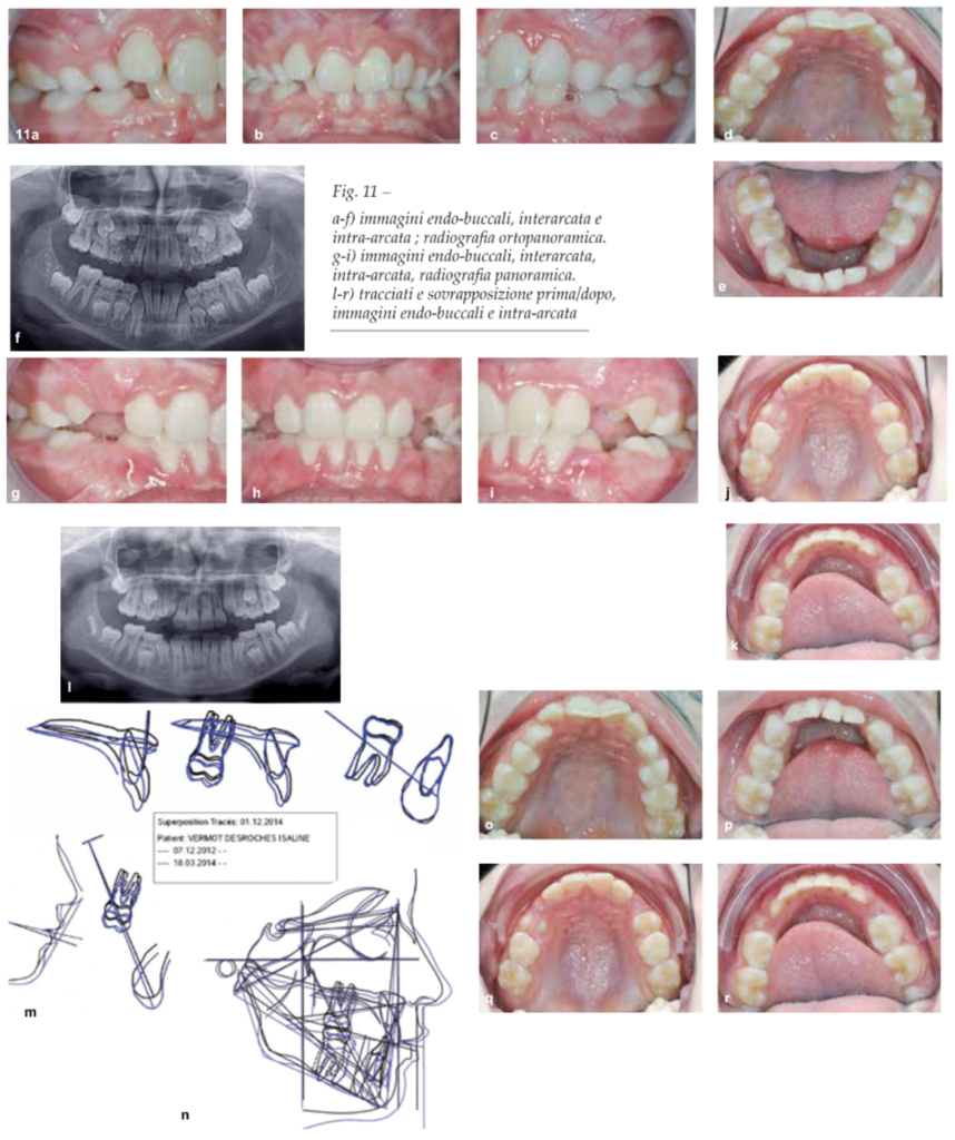 img endo-buccali 7 - Dentalsim